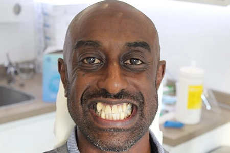 Before & After Dental Treatment | Smile Rooms | Smile Gallery